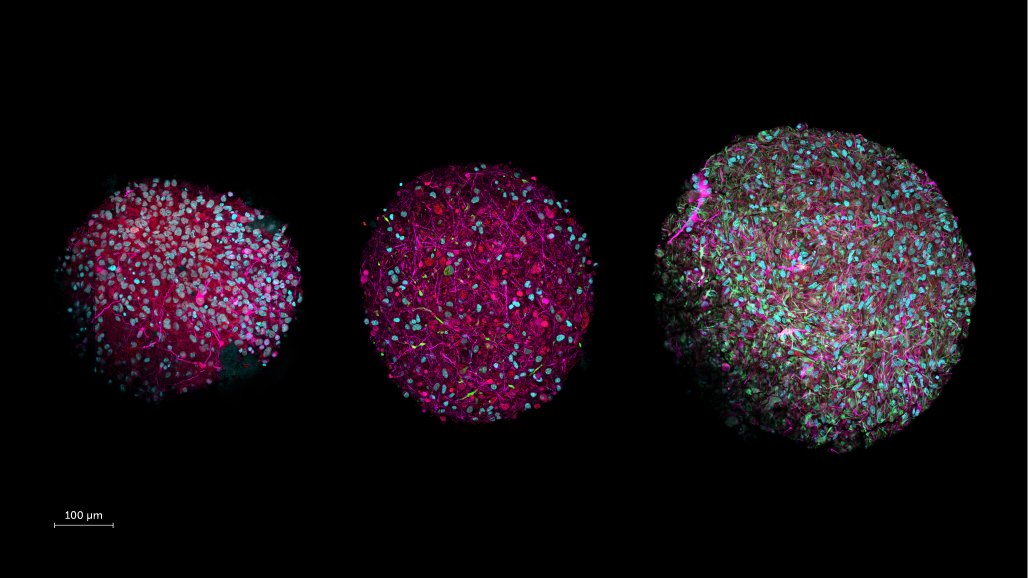 What are ‘biocomputers’ and what can they tell us about the human brain?